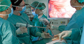 Toracoscopia. Síntomas, causas y tratamientos de Toracoscopia | Doctuo