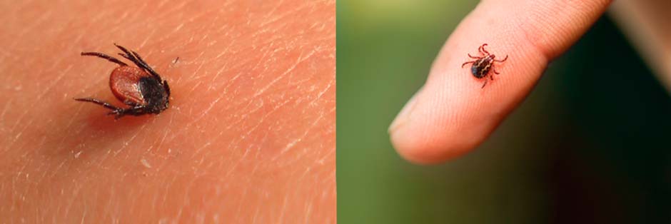 Picadura de garrapata | Doctuo
