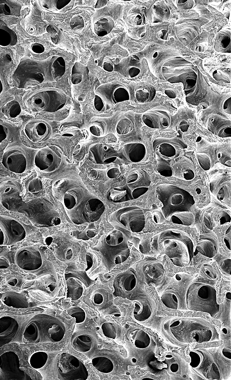 Osteomalacia. Síntomas, causas y tratamientos de Osteomalacia | Doctuo