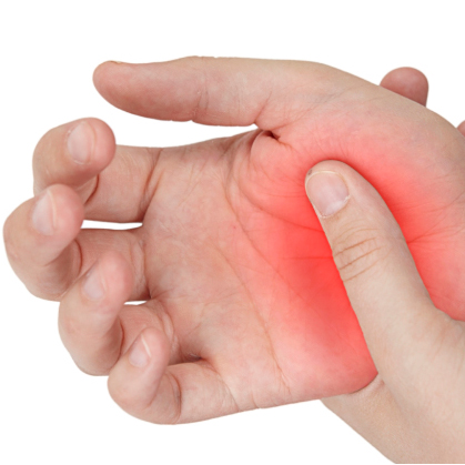 Tendinitis de mano. Síntomas, causas y tratamientos de Tendinitis de ...