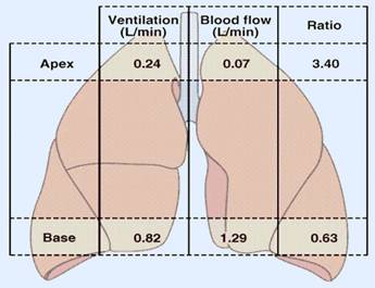 Reducción del volumen pulmonar. Síntomas, causas y tratamientos de ...