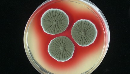 Hongos Filamentosos. Síntomas, causas y tratamientos de Hongos ...